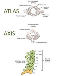 13 Secrets of Cervicalgia Headaches with exercises and treatments ...